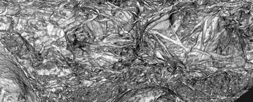 mucoderm® - botiss biomaterials GmbH